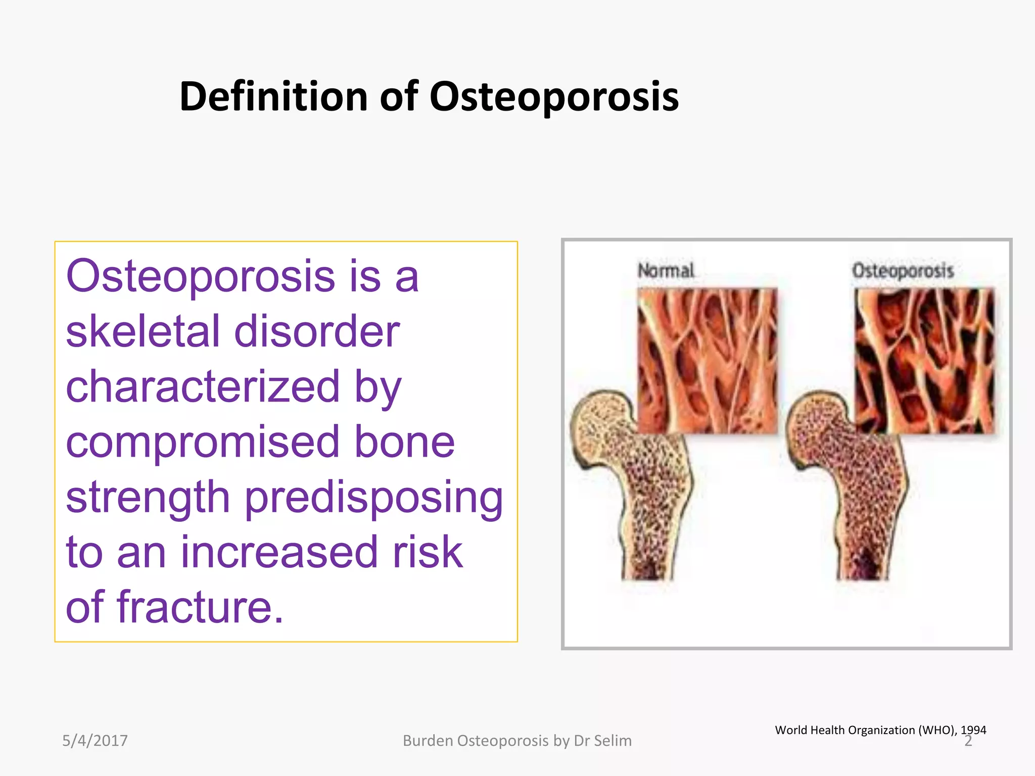 Osteoprosis: Evaluation, Management and Prevention by Dr Shahjada Selim ...