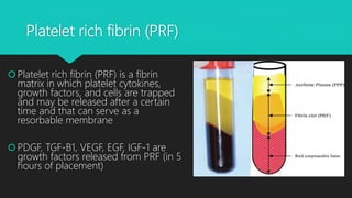 Osteoradionecrosis | PPTX