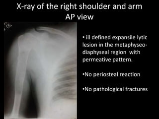Limb salvage surgery in osteosarcoma- clinical meeting | PPTX