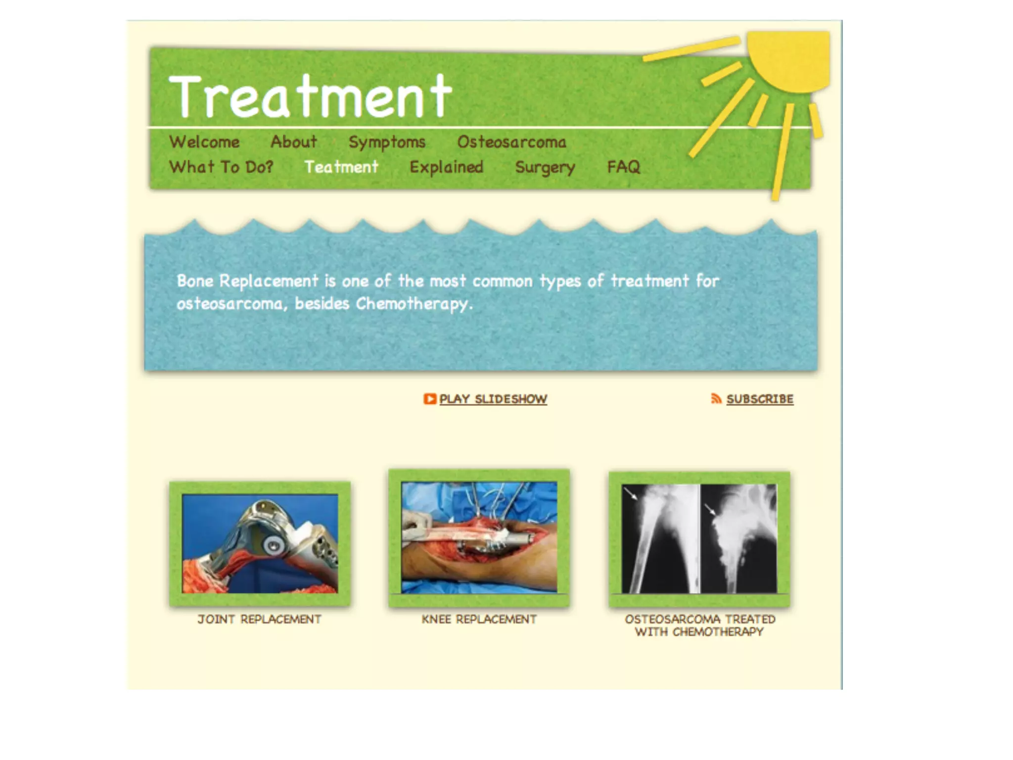 Osteosarcoma by Taylor Freeman | KEY