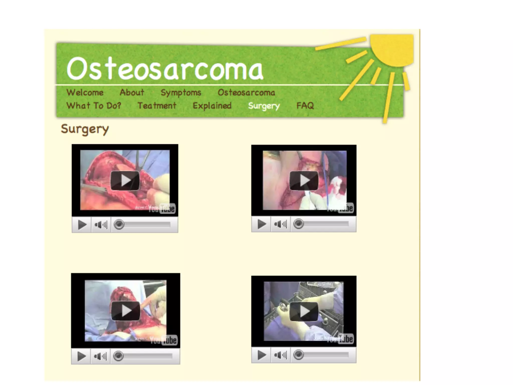 Osteosarcoma by Taylor Freeman | KEY
