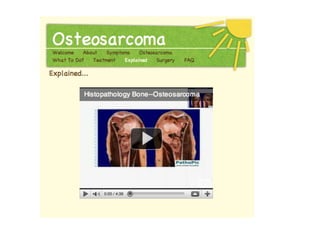 Osteosarcoma by Taylor Freeman | KEY