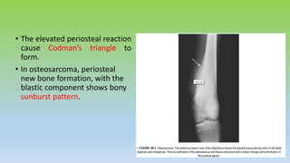 Osteosarcoma and Radiation therapy | PPTX