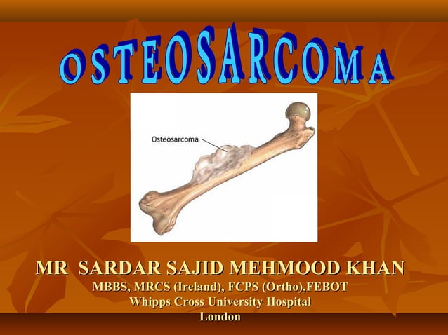 Osteosarcoma | PPT