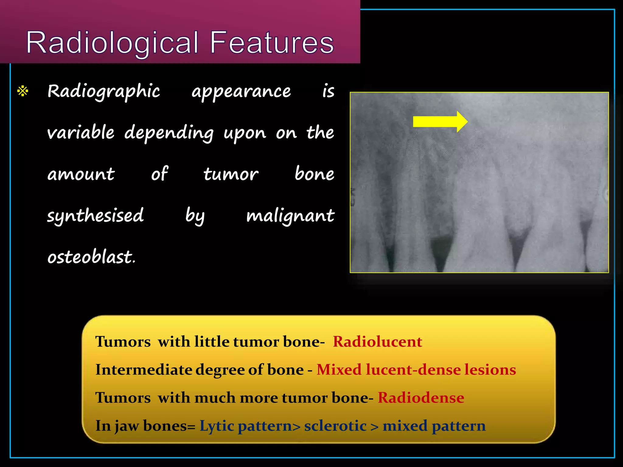 osteosarcoma.ppt