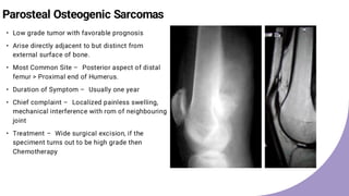 Osteosarcoma.pdf