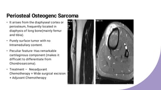 Osteosarcoma.pdf