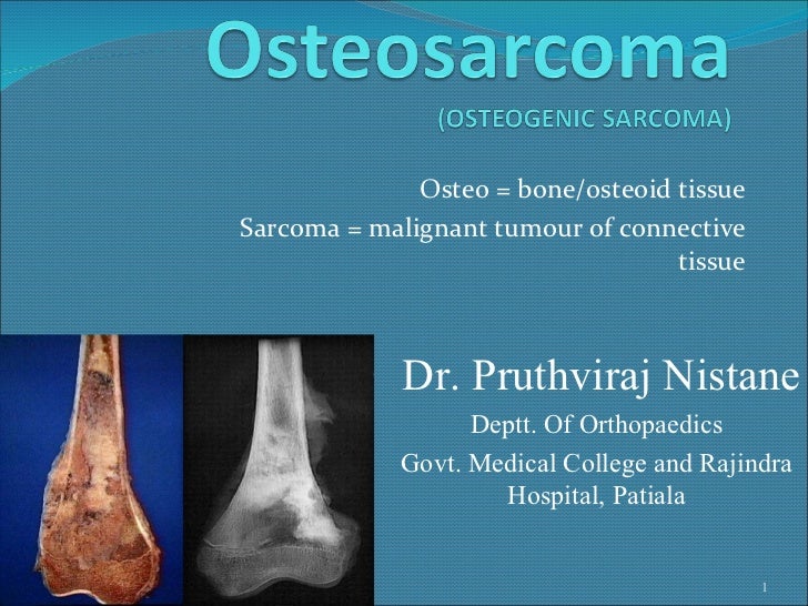 Osteosarcoma (1)