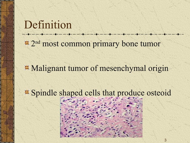 Osteosarcoma | PPT