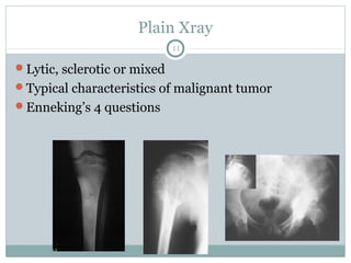 Osteosarcoma[2] | PPT