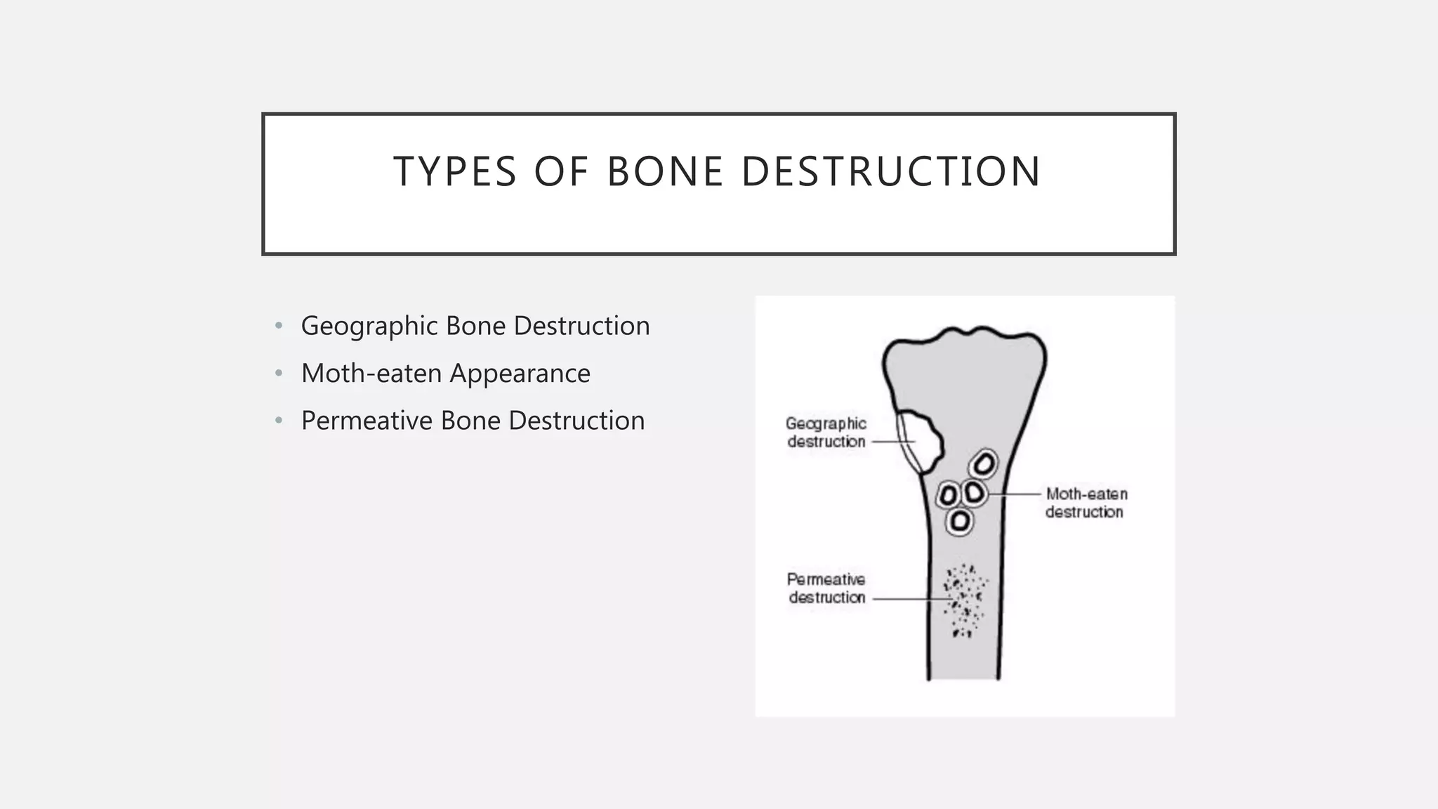 Osteosarcoma & Ewings | PPTX