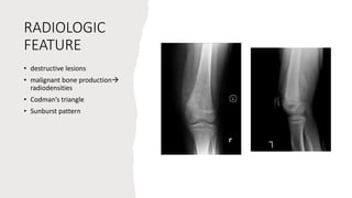 Osteosarcoma & Ewing Sarcoma.pptx
