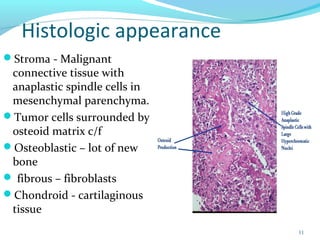 Osteosarcoma Histology