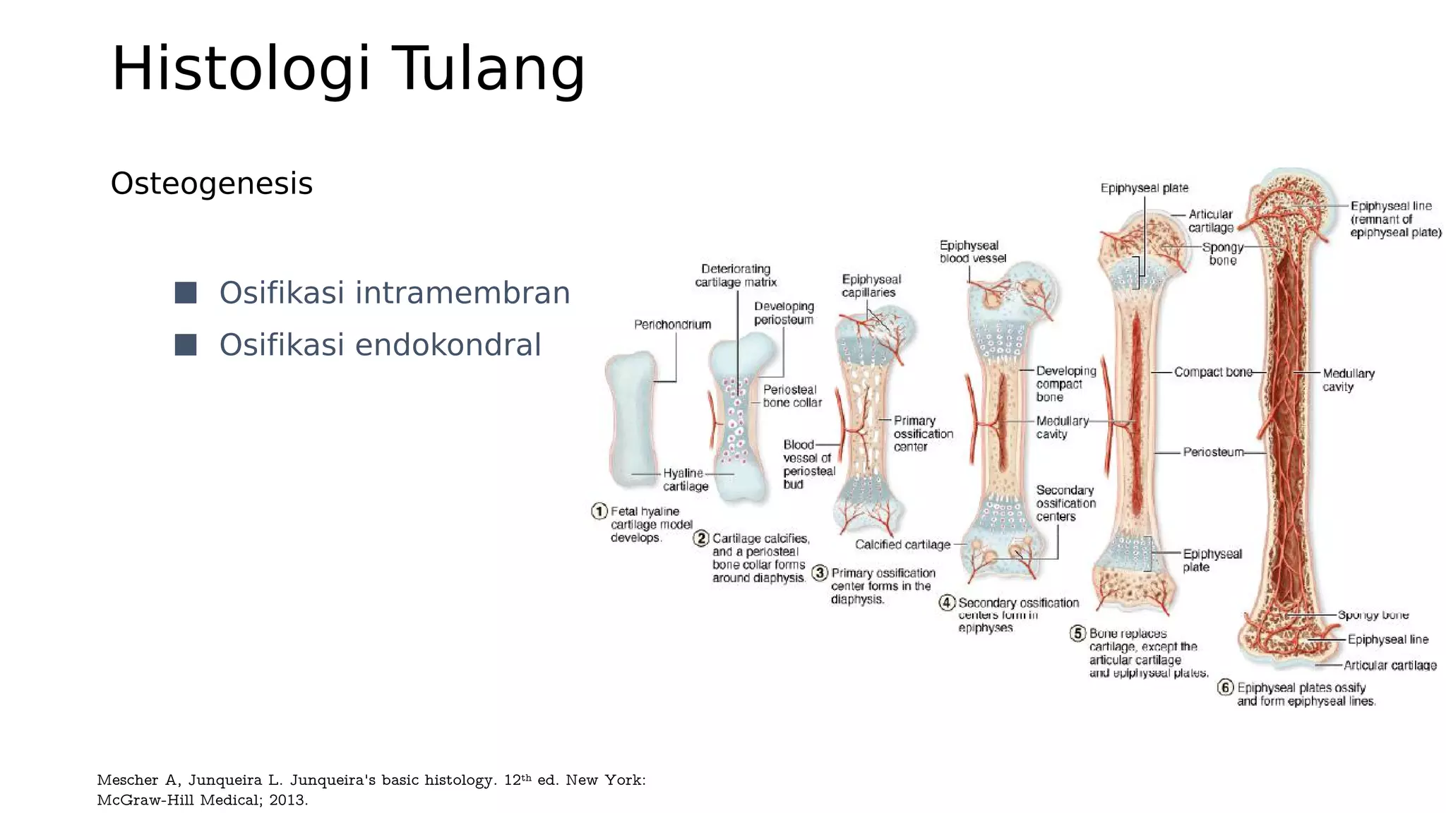 Osteosarkoma Sobri Ppt
