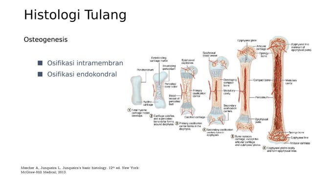 Osteosarkoma sobri | PDF