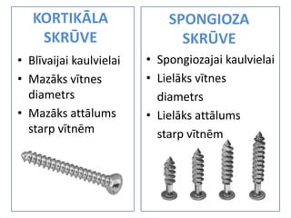 OSTEOSINTĒZES PAMATPRINCIPI | PPTX