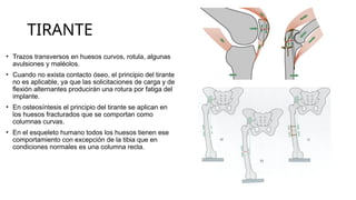 OSTEOSÍNTESIS BIOMECÁNICOS t- copia.pptx