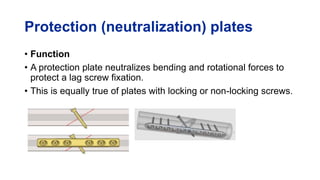 osteosynthesis.pptx