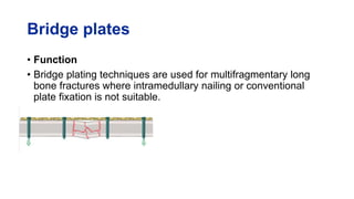 osteosynthesis.pptx