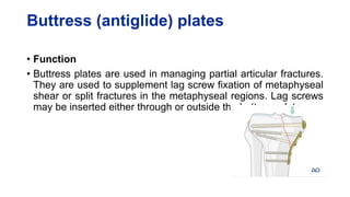 osteosynthesis.pptx