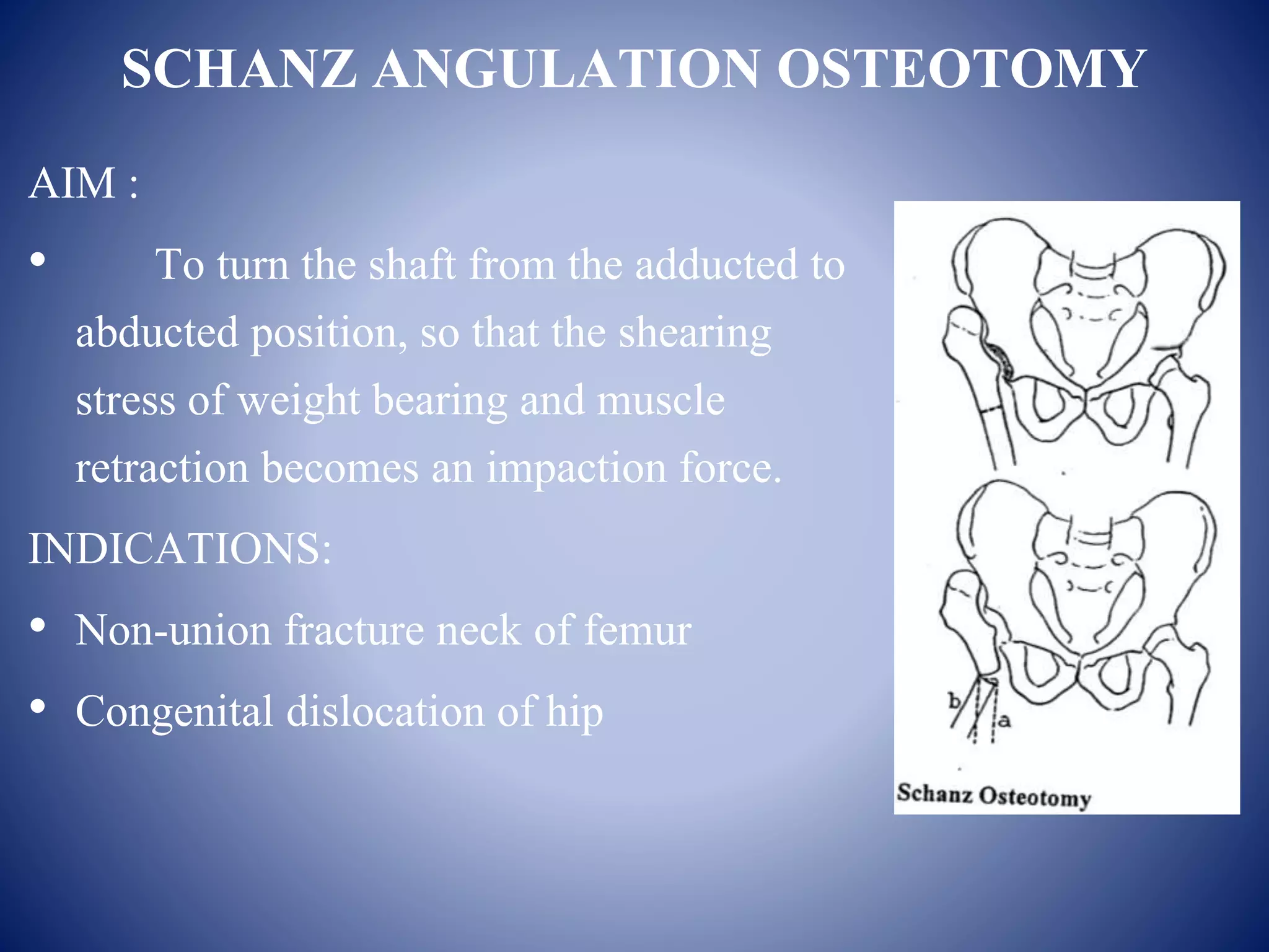 Osteotomies around the hip | PPTX