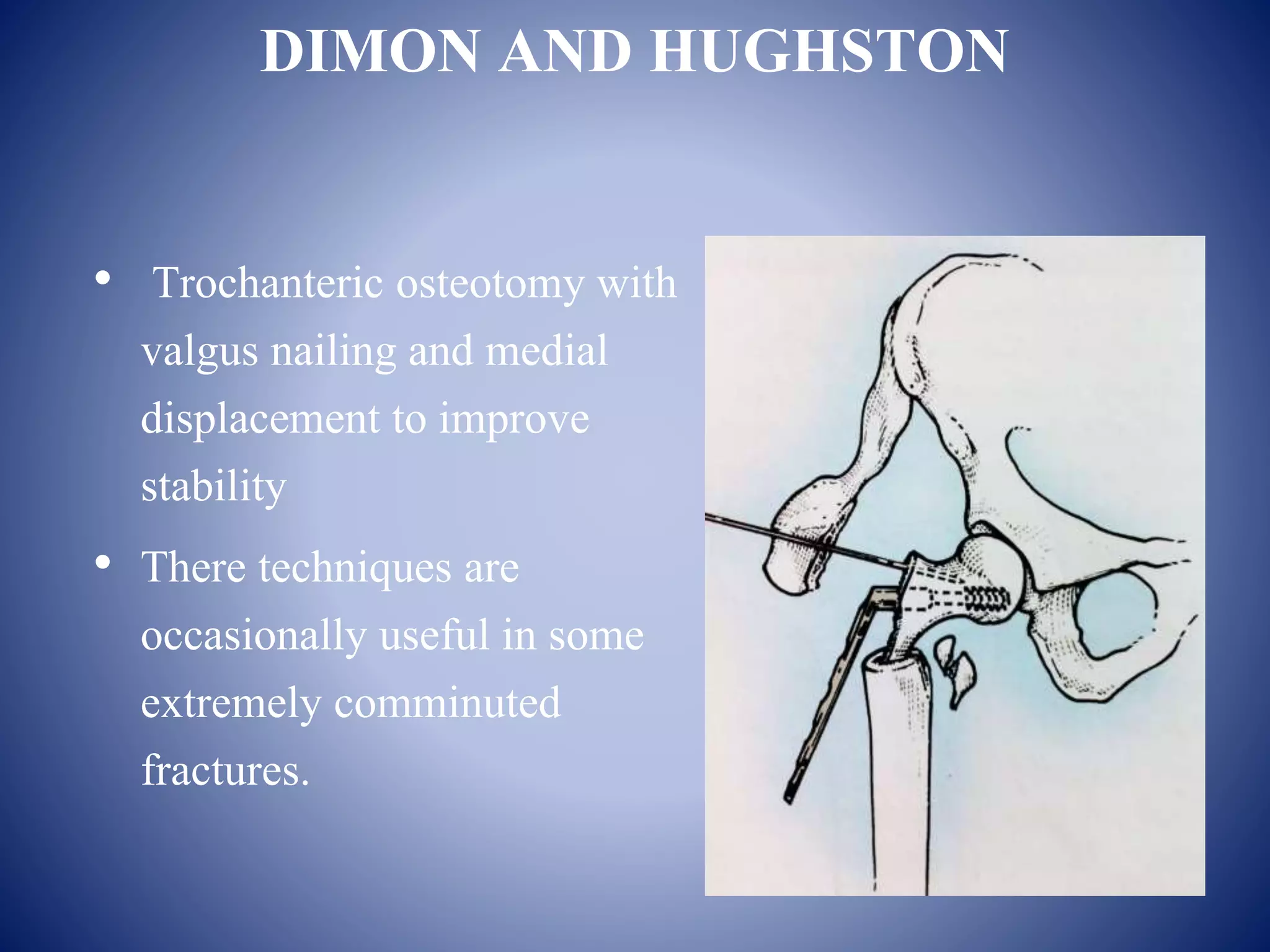 Osteotomies around the hip | PPTX | Death, Injury, or Military Conflict | Sensitive Topics