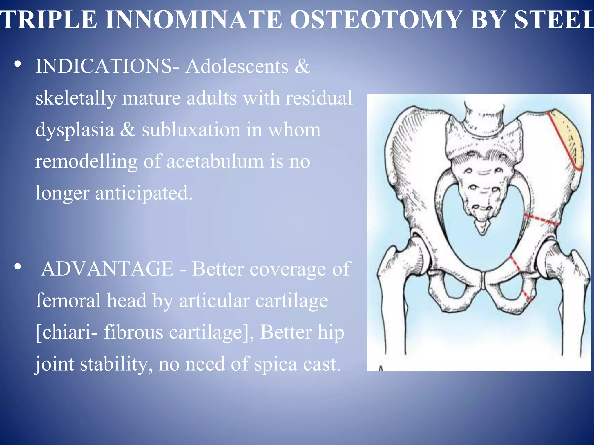 Osteotomies around the hip | PPTX