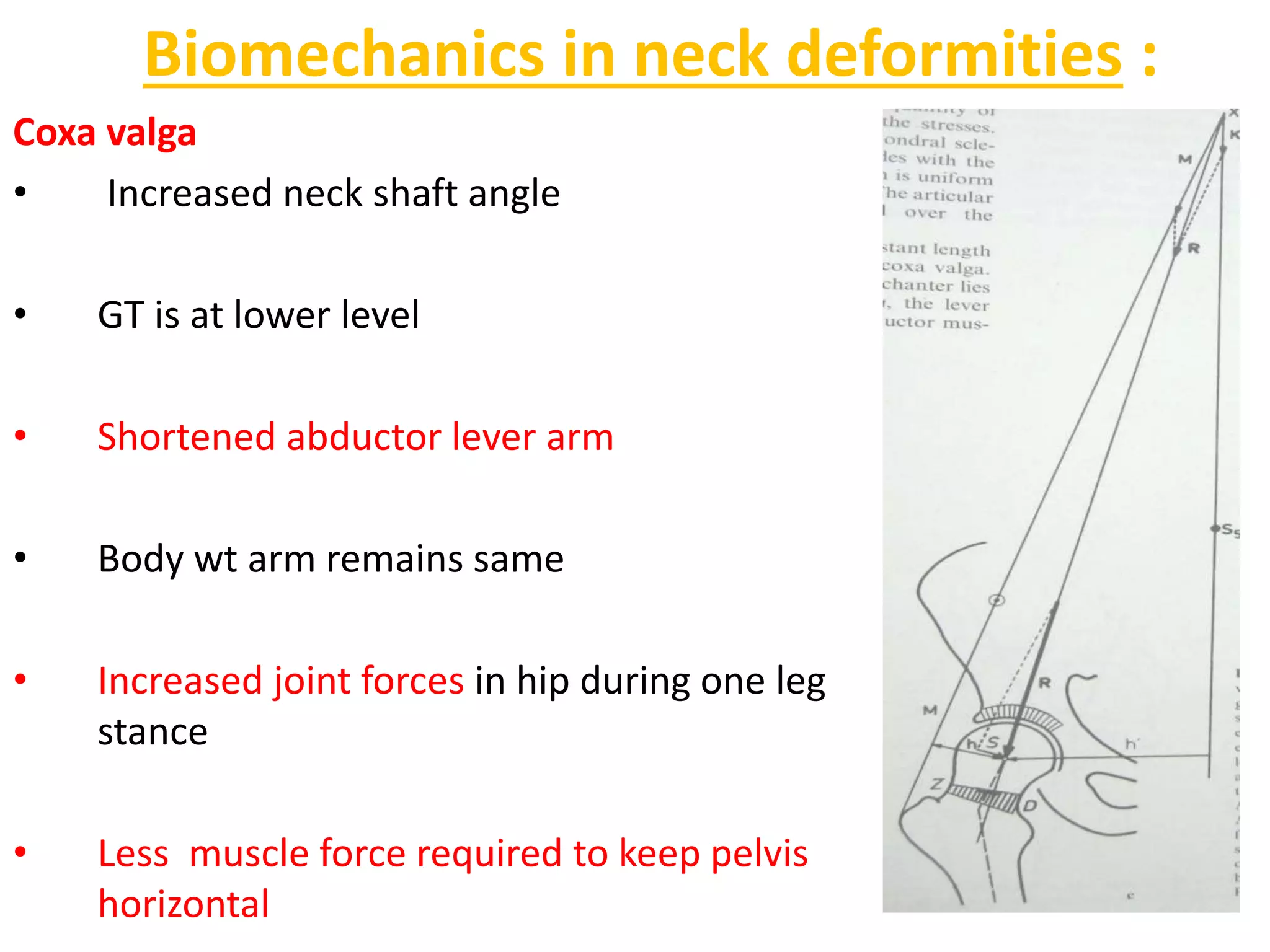 Osteotomies around the hip | PPTX