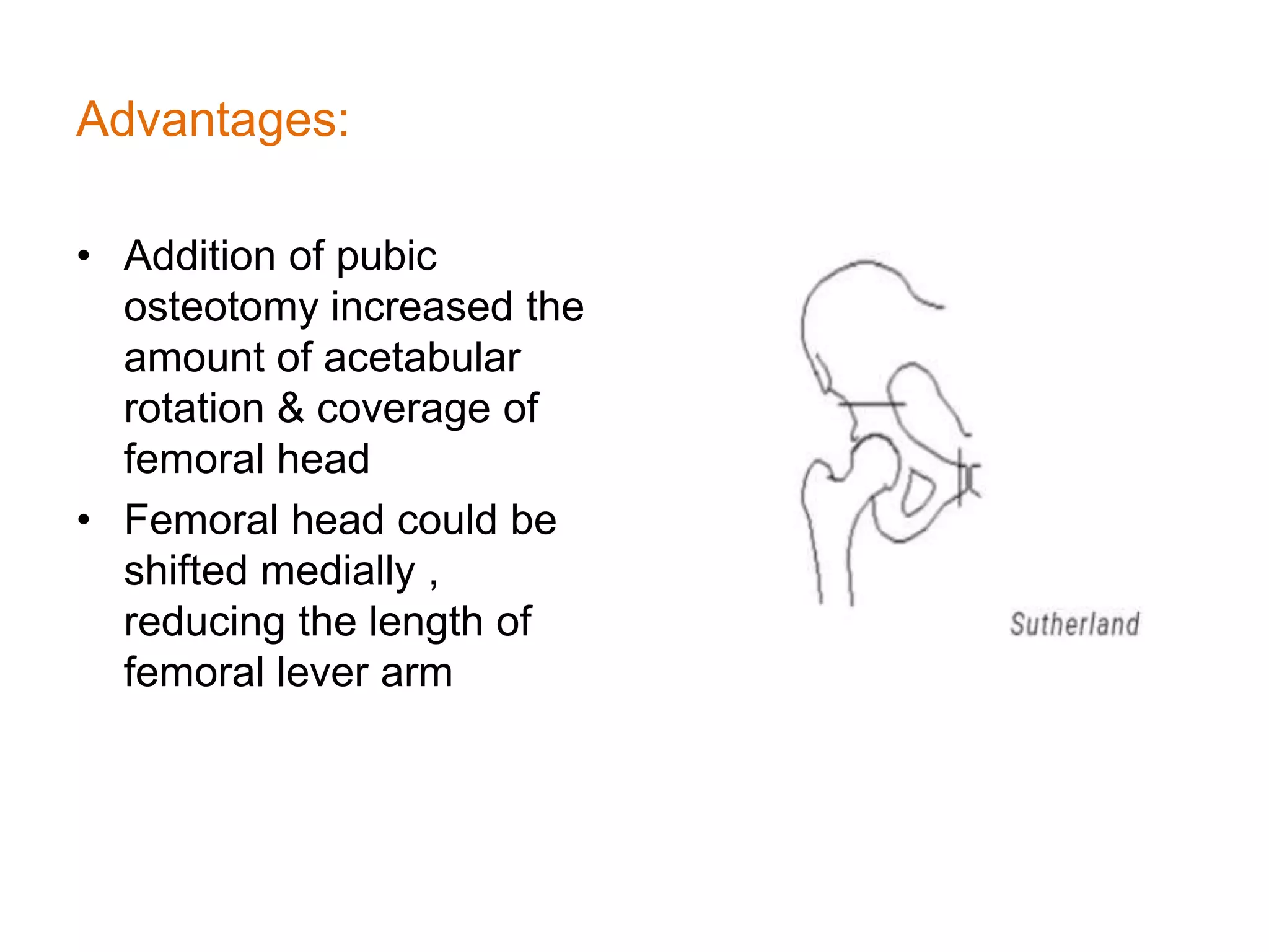 Osteotomies around the hip | PPTX