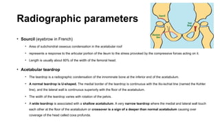OSTEOTOMIES AROUND THE HIP (Acetabular and Proximal Femur).pptx