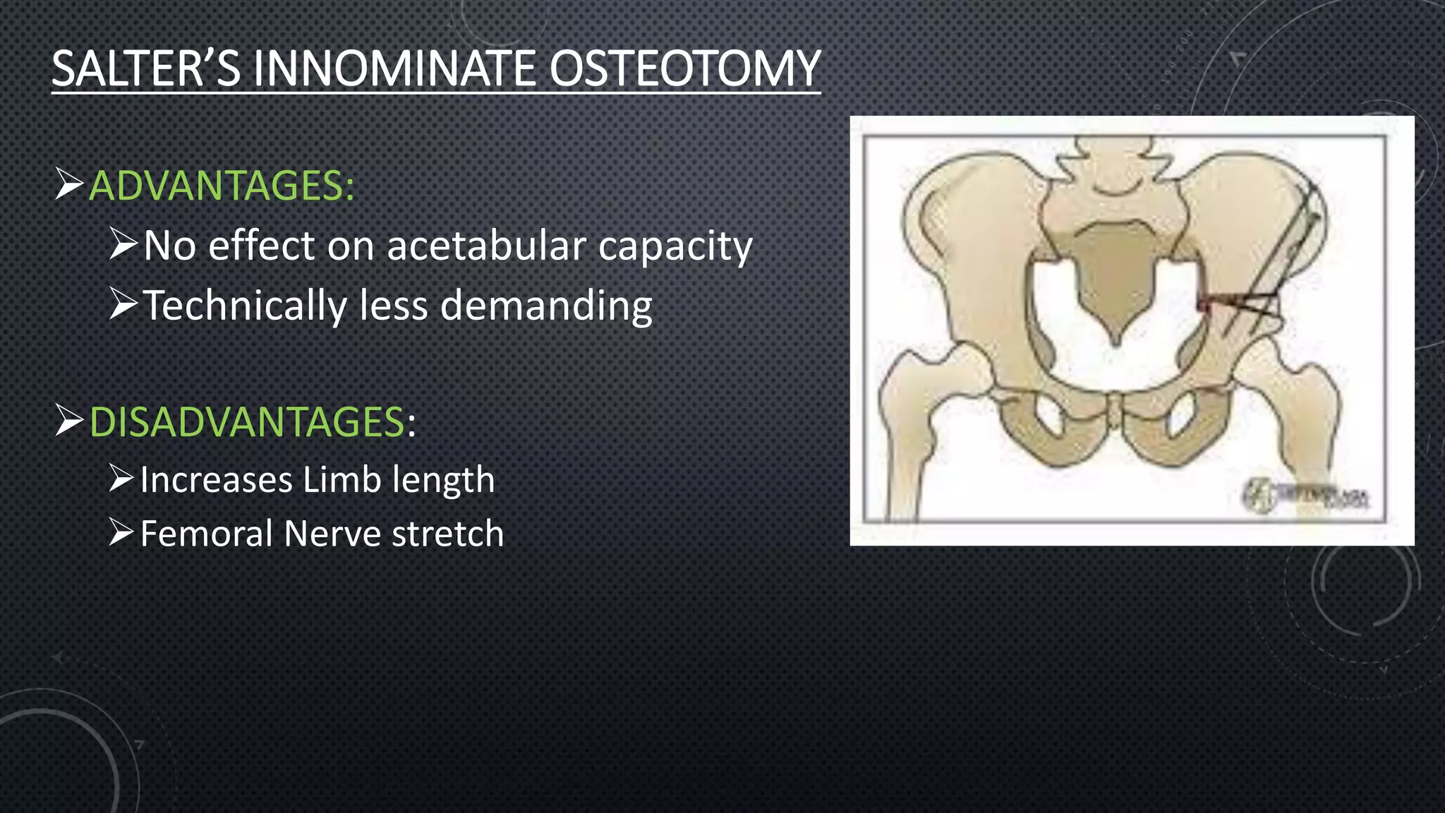 Osteotomies around the hip in DDH | PPTX