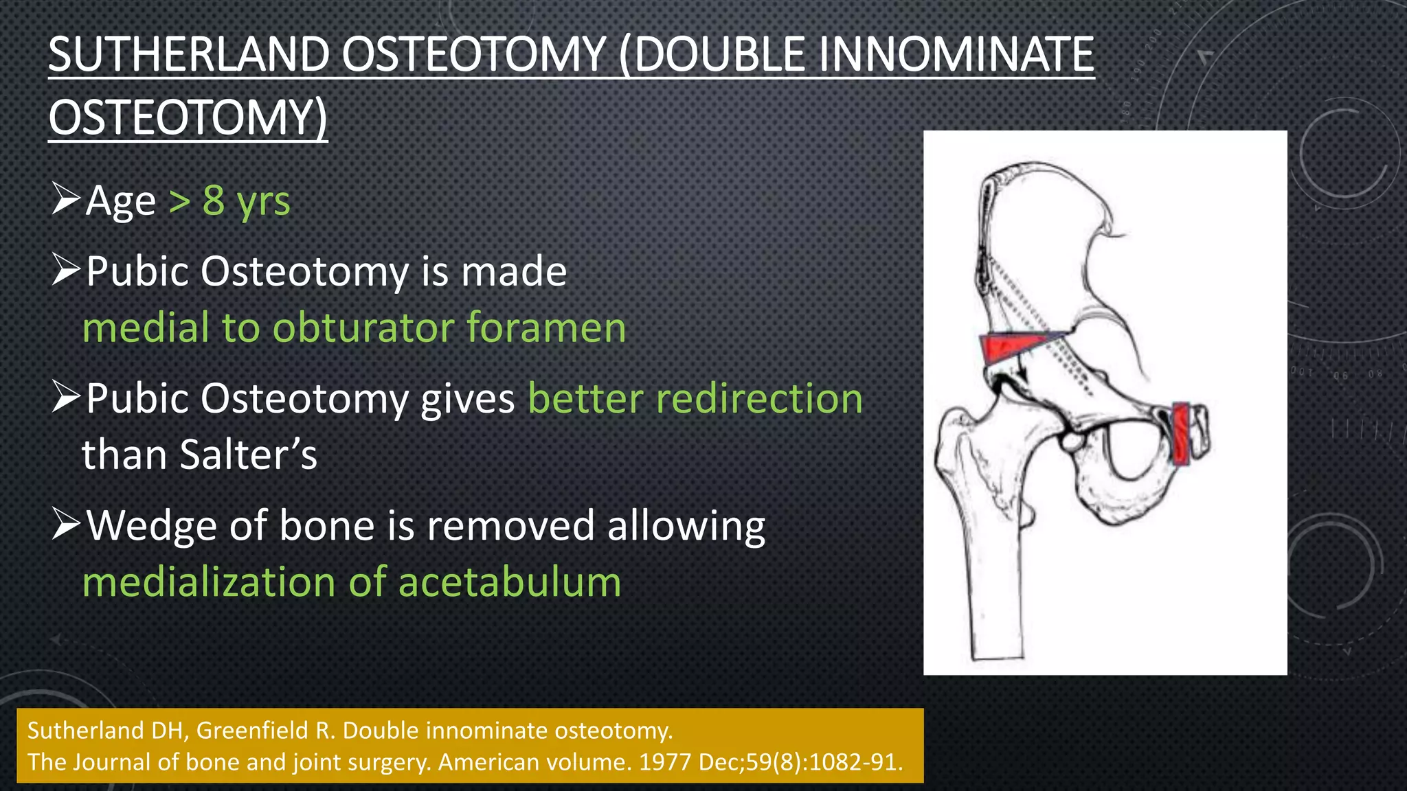 Osteotomies around the hip in DDH | PPTX
