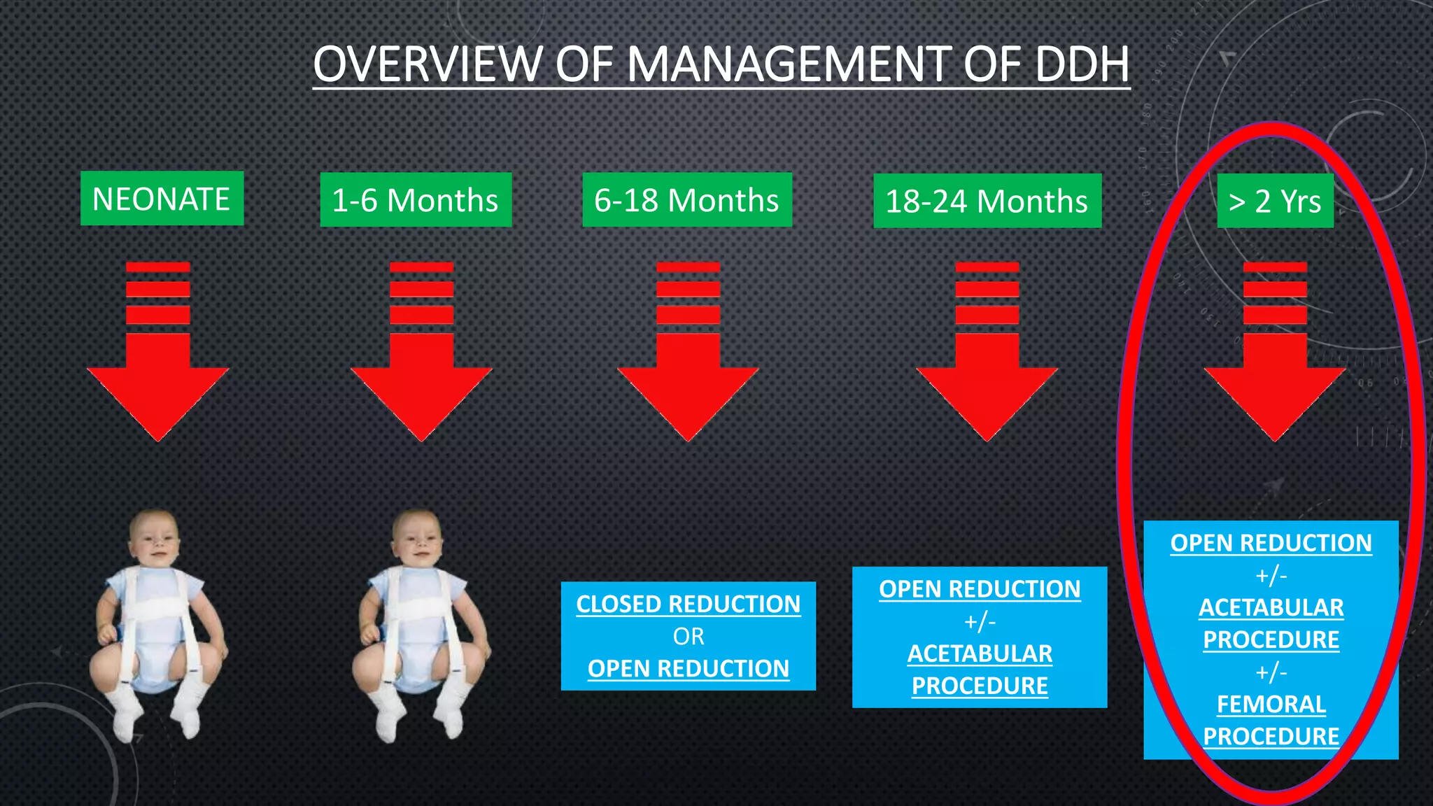 Osteotomies around the hip in DDH | PPTX