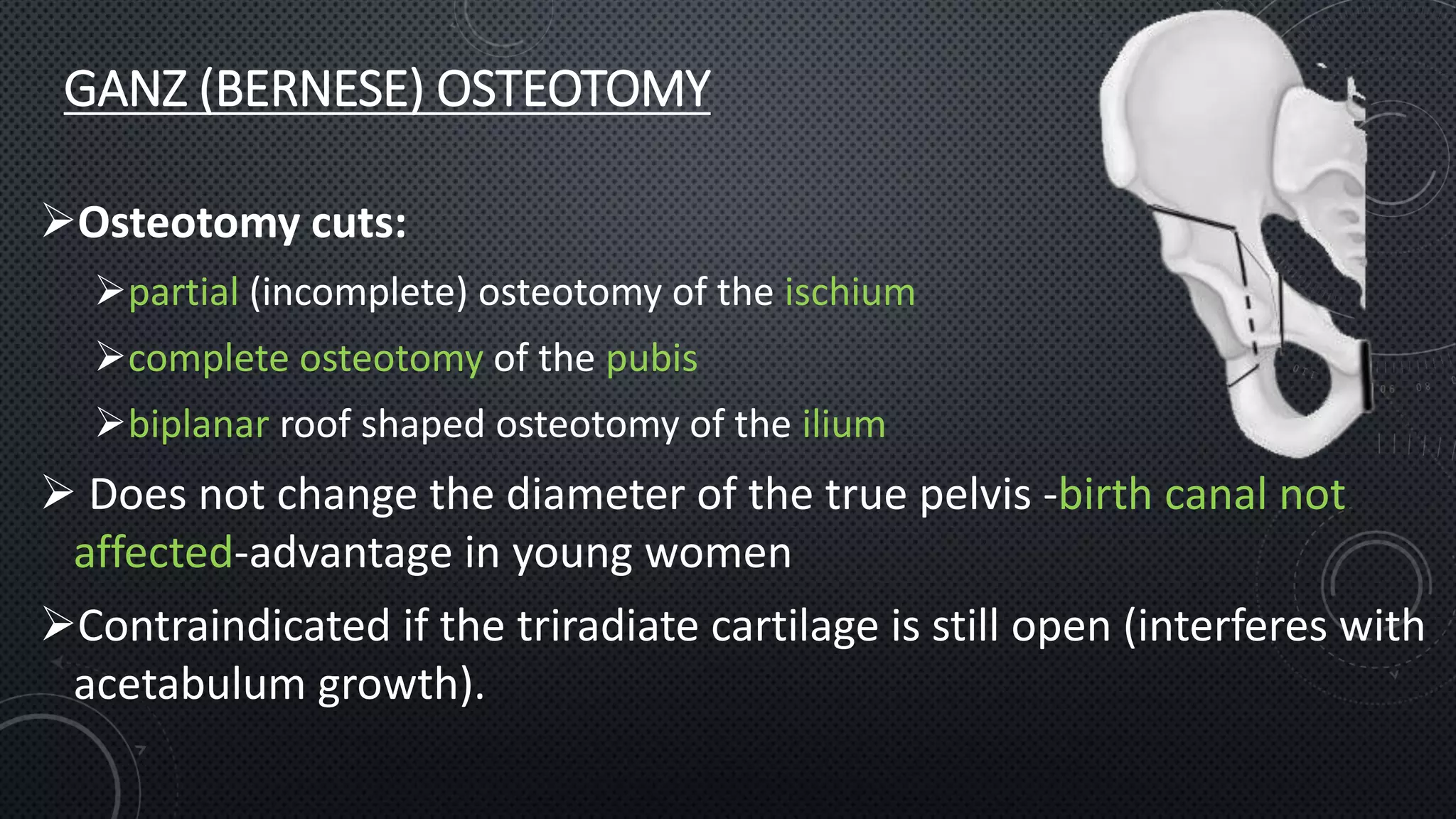 Osteotomies around the hip in DDH | PPTX