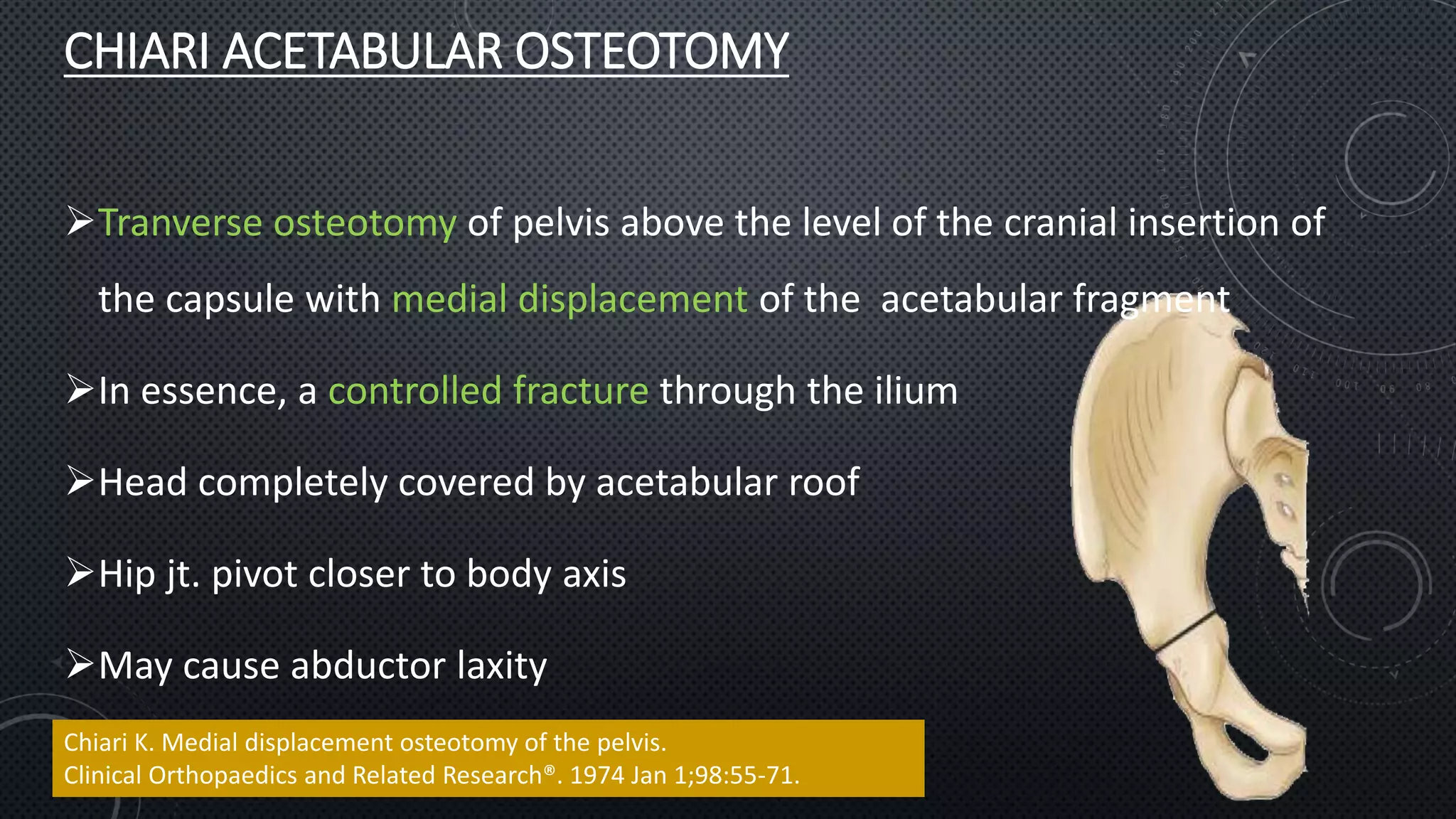 Osteotomies around the hip in DDH | PPTX