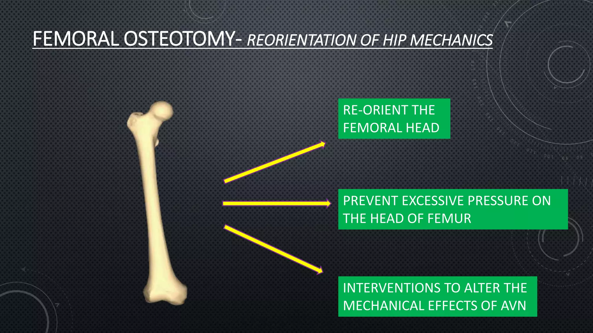 Osteotomies around the hip in DDH | PPTX