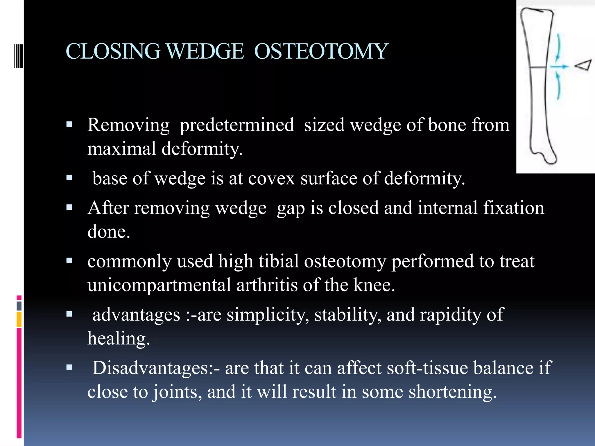 Osteotomy | PPTX
