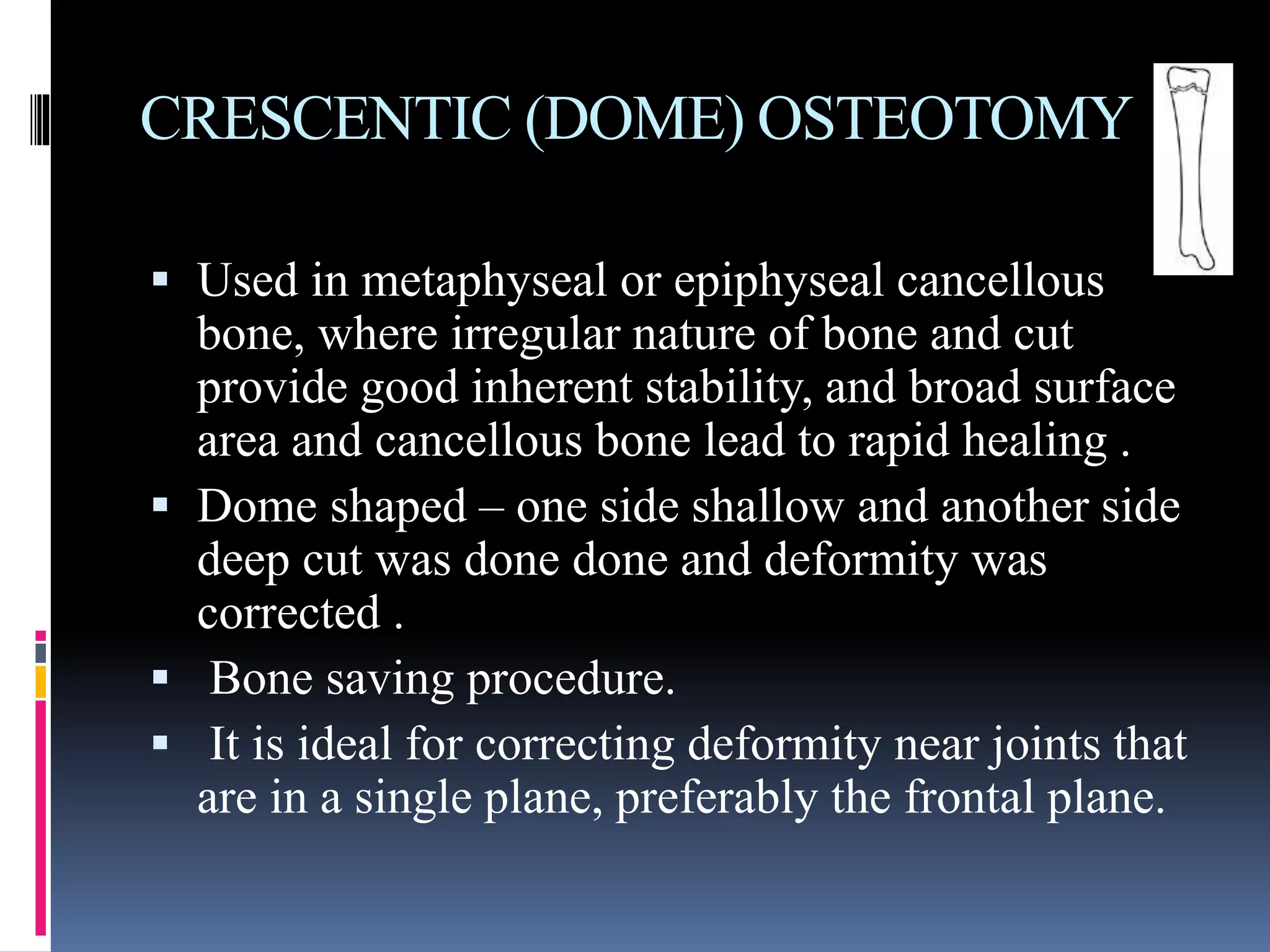 Osteotomy | PPTX