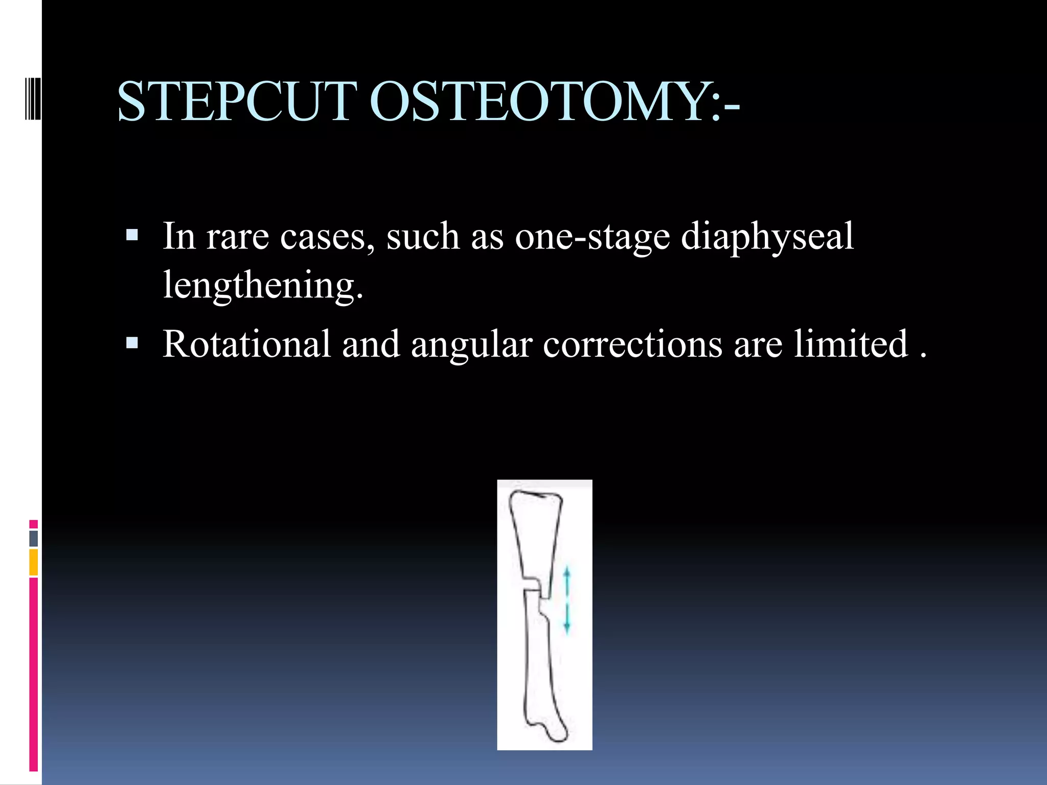 Osteotomy | PPTX