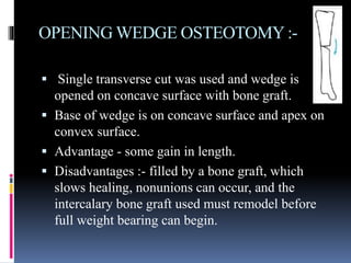 Osteotomy | PPTX