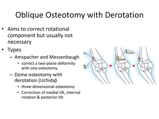 Osteotomy around elbow | PPTX | Death, Injury, or Military Conflict ...