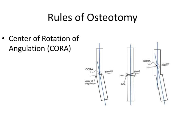 Osteotomy around elbow | PPTX | Death, Injury, or Military Conflict ...