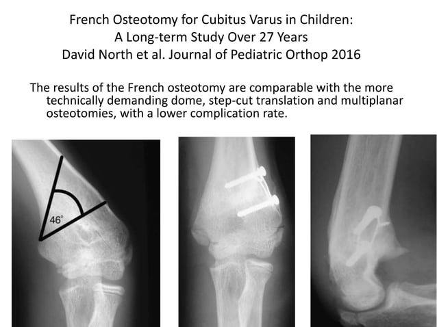 Osteotomy around elbow | PPTX | Death, Injury, or Military Conflict ...