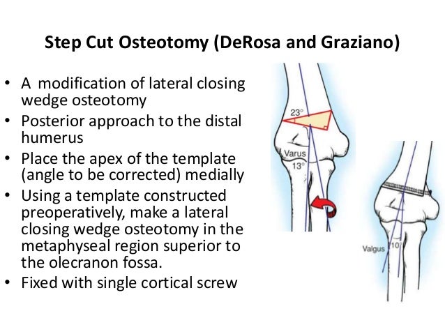 Osteotomy around elbow