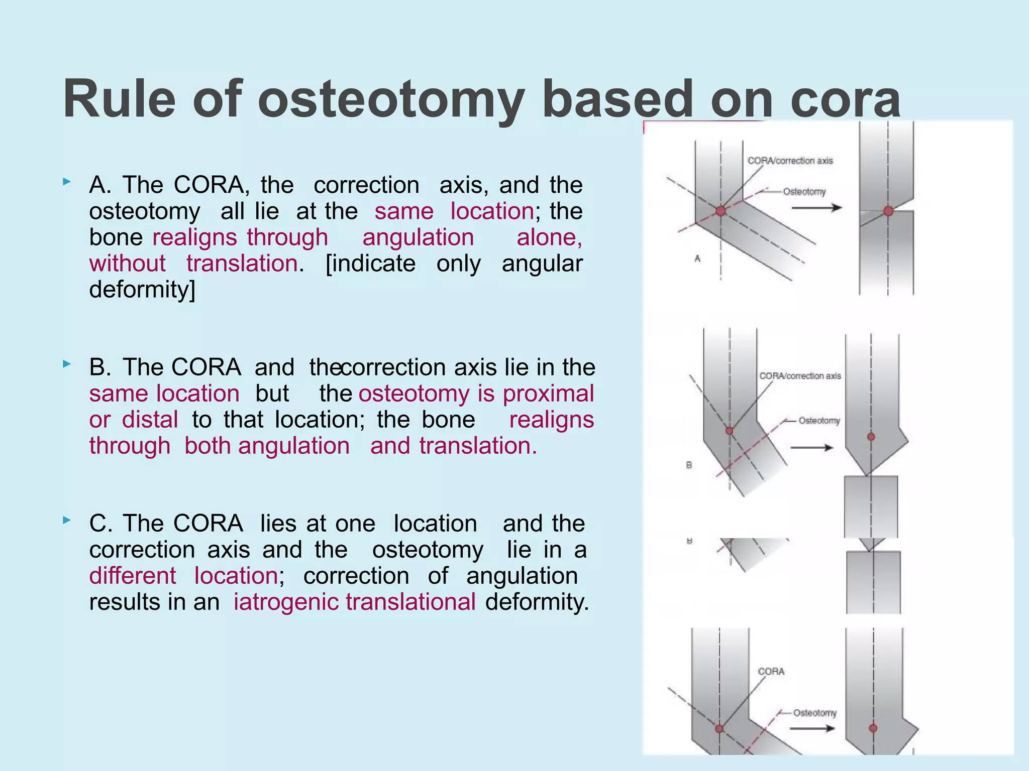 Osteotomy around knee dr shankar jangid (1) | PDF