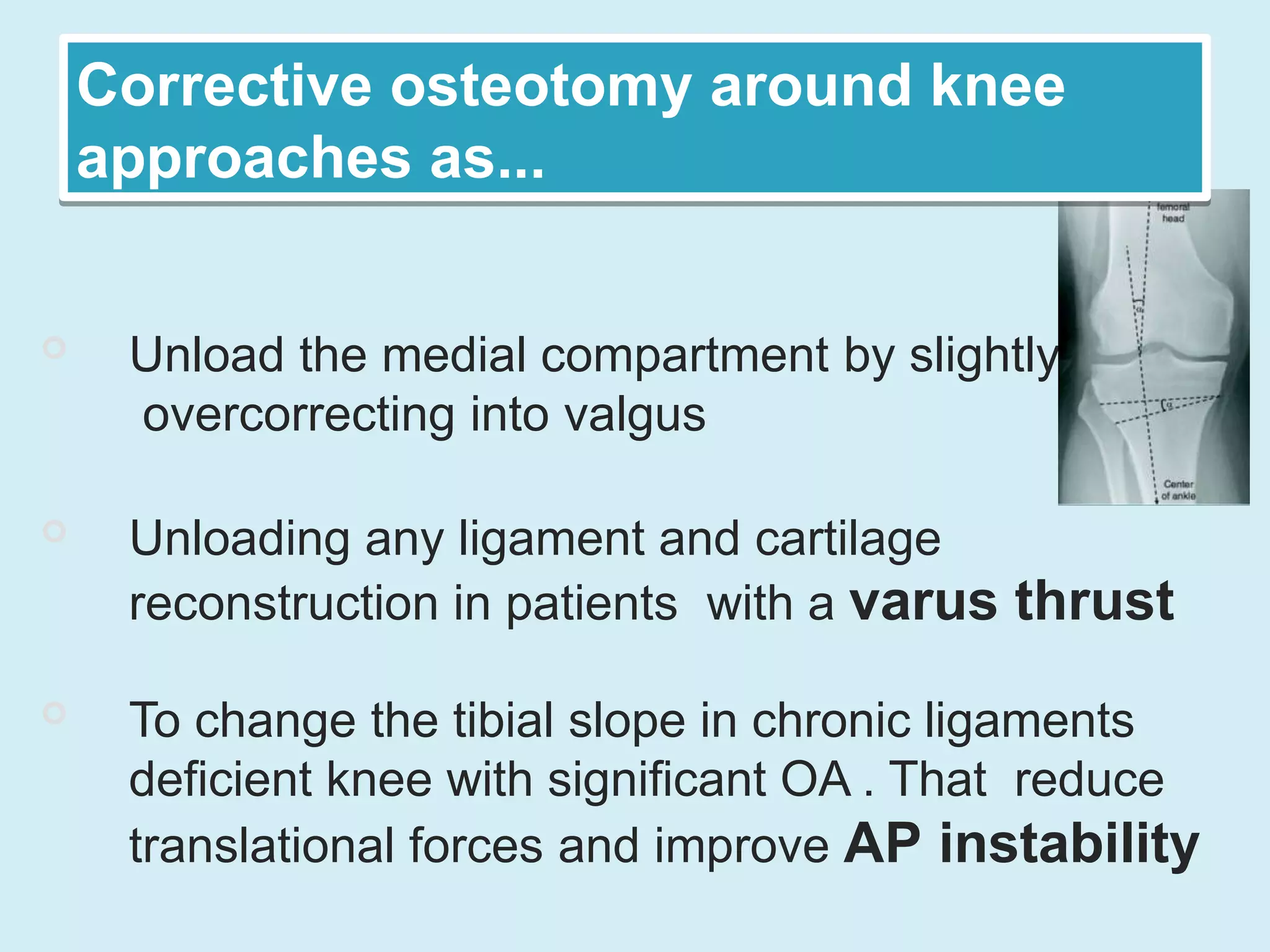 Osteotomy around knee dr shankar jangid (1) | PDF