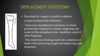 Osteotomy and physiotherapy | PPTX