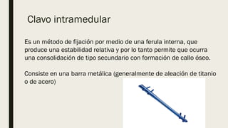ostesintesis en traumatologia y ortopedia | PPTX