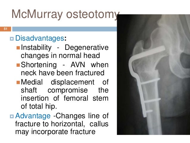 Ostetomies around hip by hemant mamc