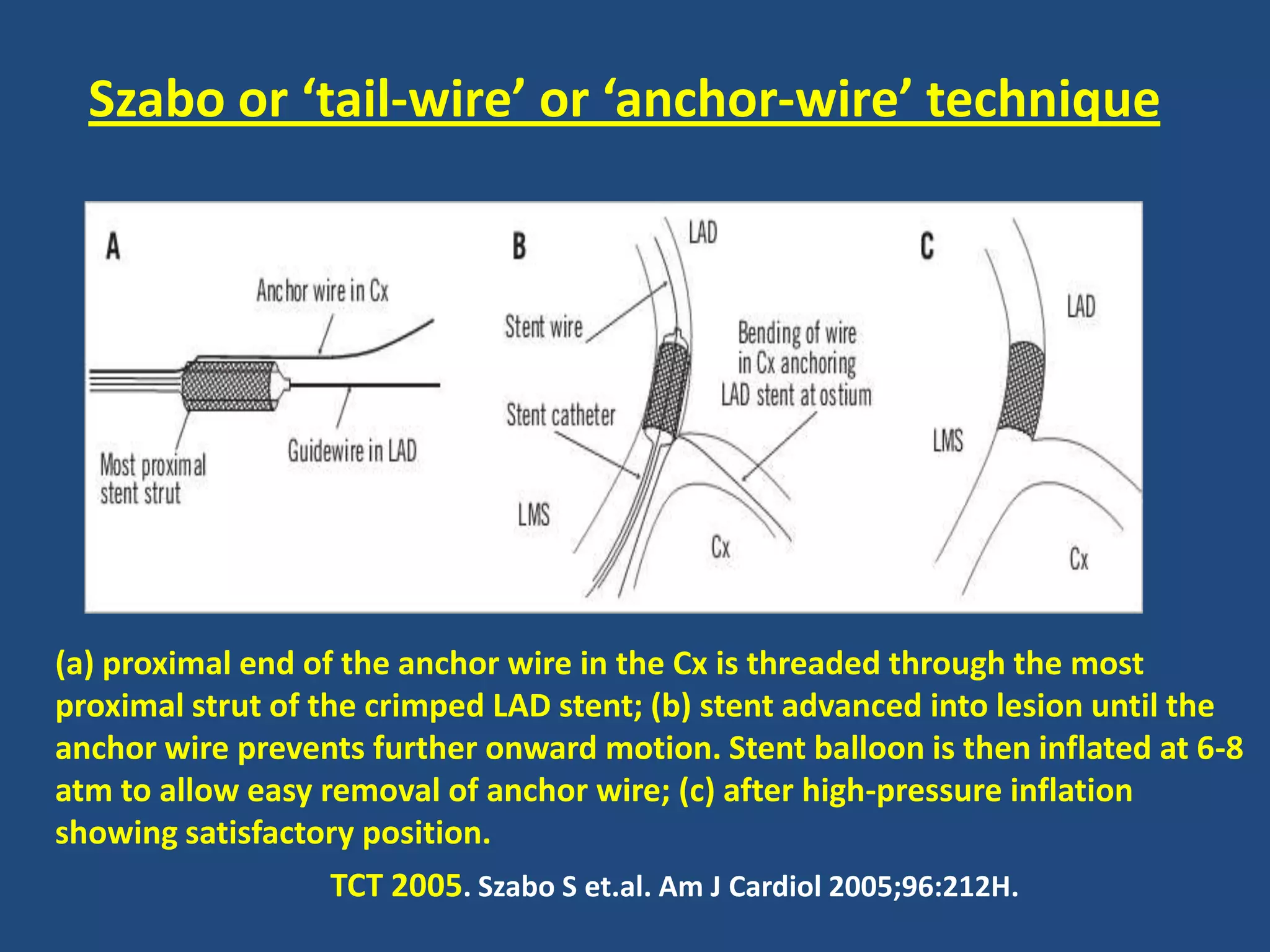 Coronary Ostial stenting techniques:Current status | PPTX